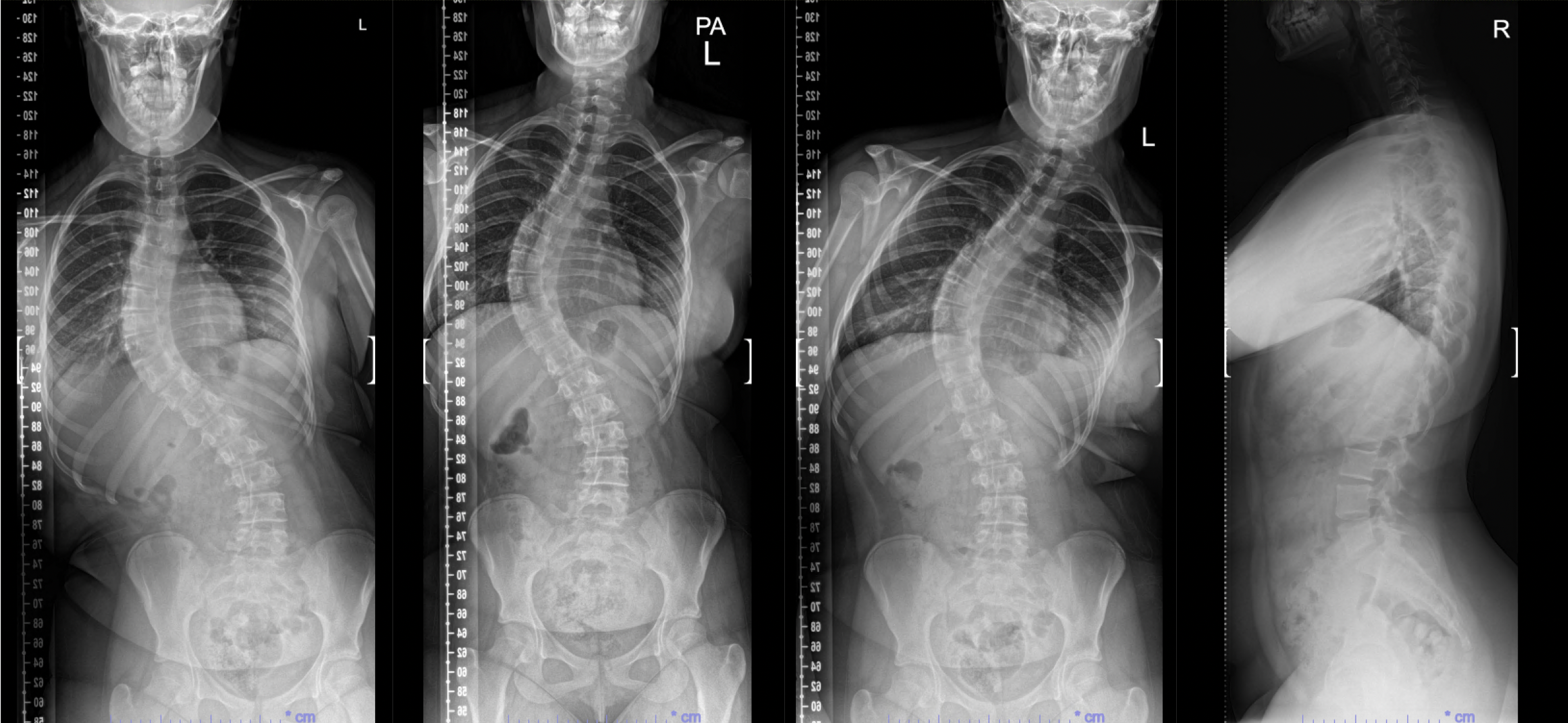 Spine Dragon - Spinal Conditions: Spinal Deformity