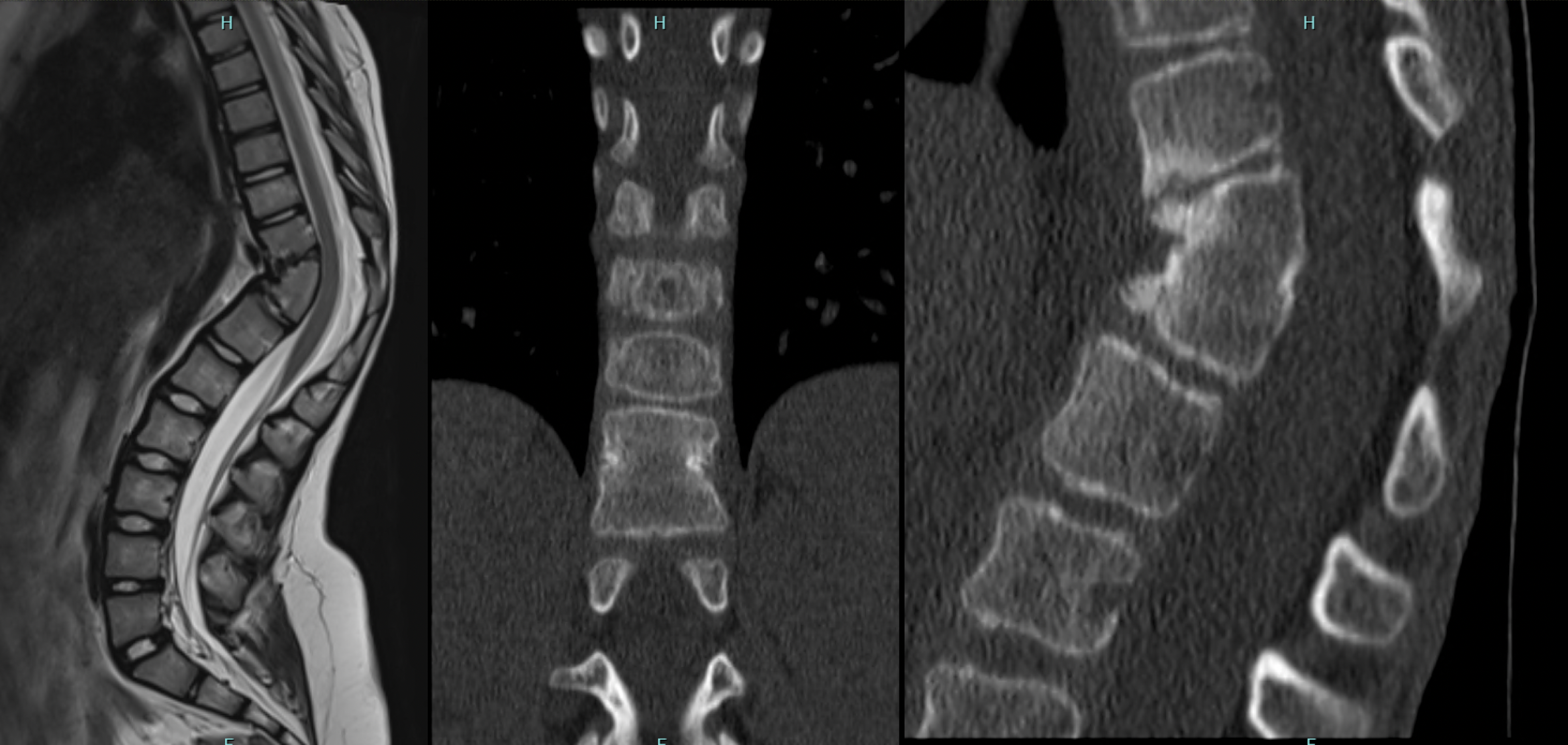 Spine Dragon - Spinal Conditions: Spinal Deformity